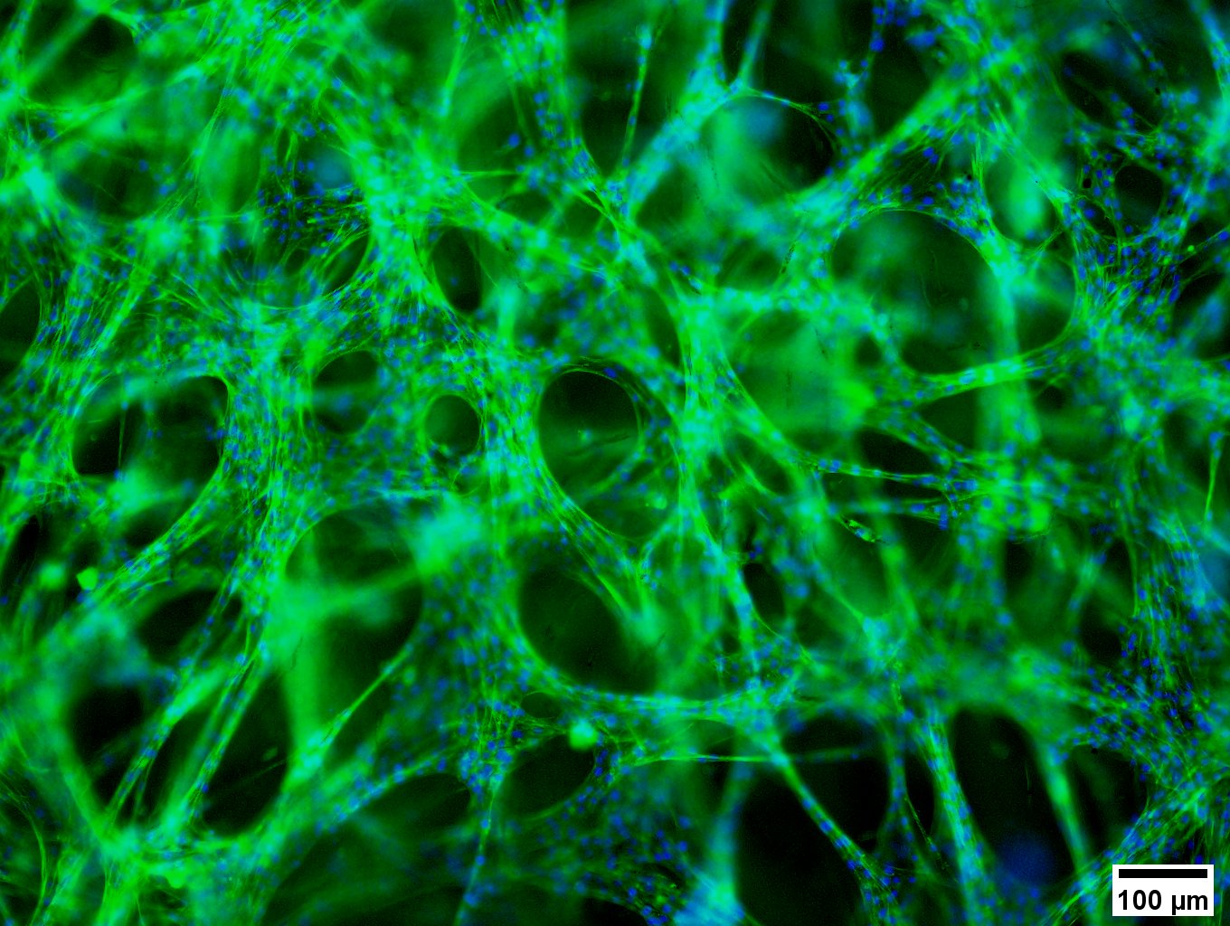 GelMA (75% Substitution） – NEOrgan